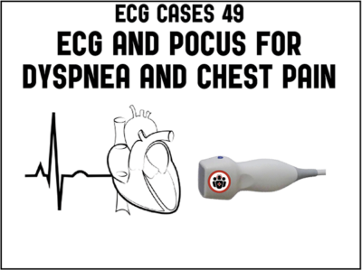 ECG and PoCUS for Chest Pain and Dyspnea | ECG Cases | EM Cases
