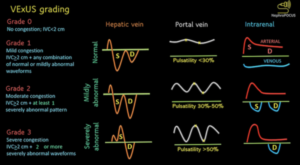 Acute Heart Failure Risk Stratification & Disposition | Emergency ...