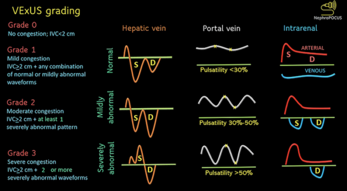 Acute Heart Failure Risk Stratification & Disposition | Emergency ...