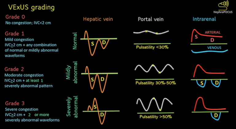 Acute Heart Failure Risk Stratification & Disposition | Emergency Medicine Cases
