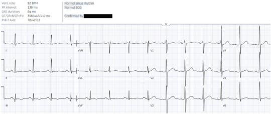 ECGs falsely labeled normal | ECG Cases | EM Cases