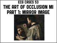 The Art of Occlusion MI: Mirror Image | ECG Cases | Emergency Medicine ...