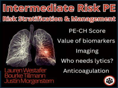 Intermediate Risk Pulmonary Embolism Risk Stratification & Management | EM Cases
