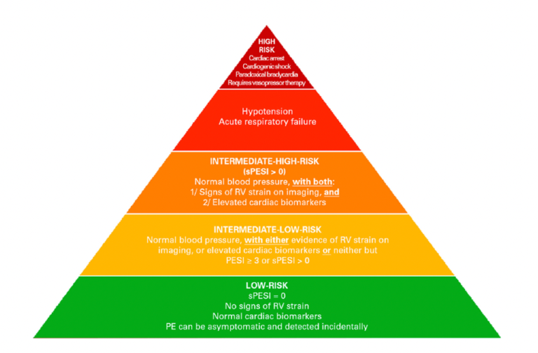 Intermediate Risk Pulmonary Embolism Risk Stratification & Management ...