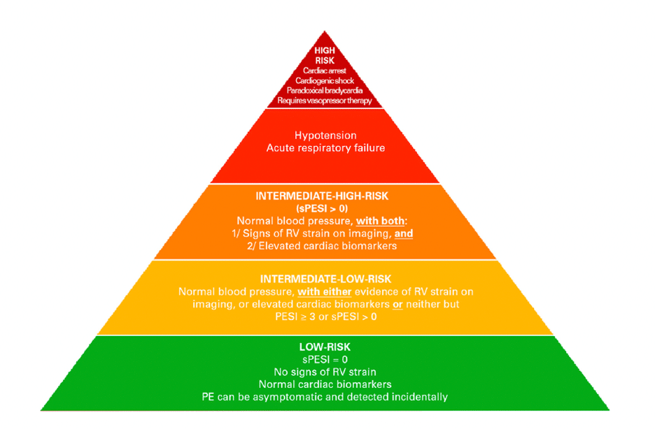 Intermediate Risk Pulmonary Embolism Risk Stratification & Management ...