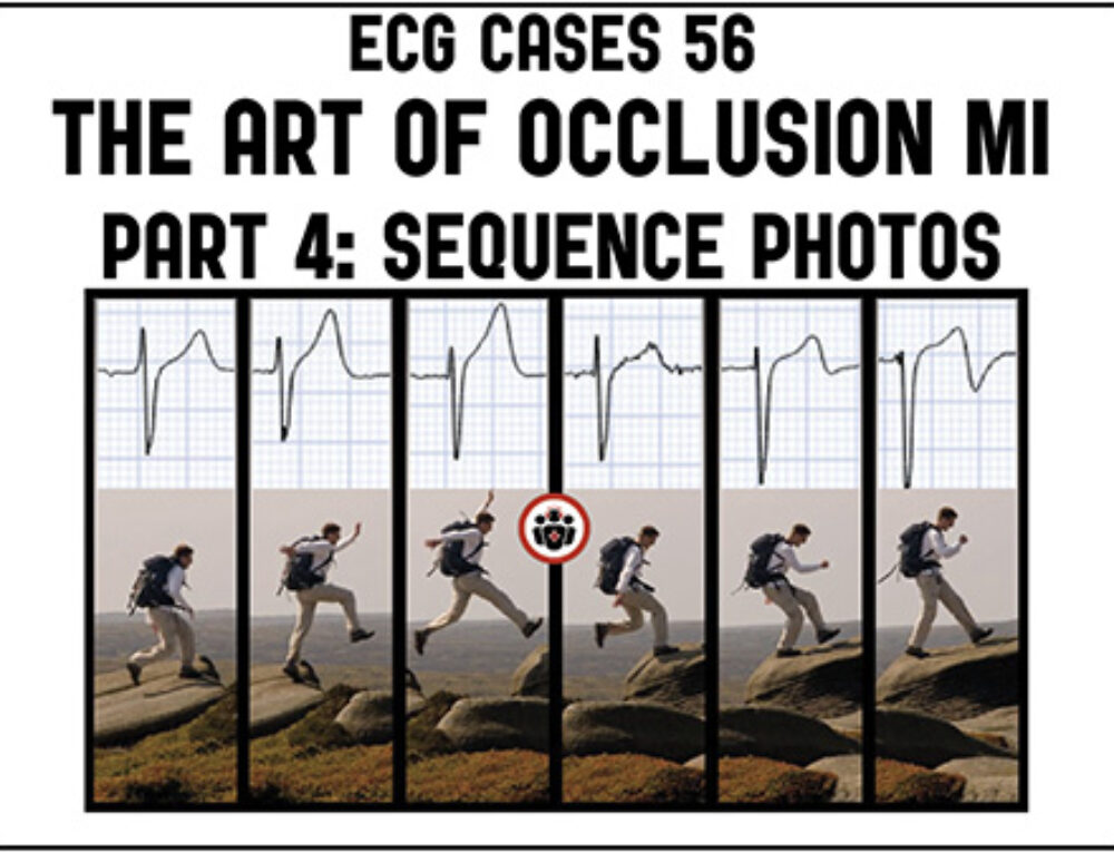 ECG Interpretation in Shortness of Breath | ECG Cases | EM Cases