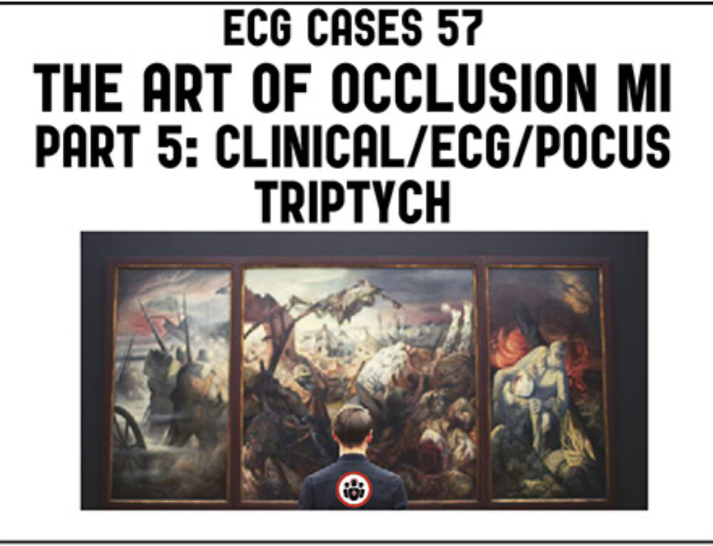 Uterine Inversion and Postpartum Hemorrhage | EM Cases | CritCases