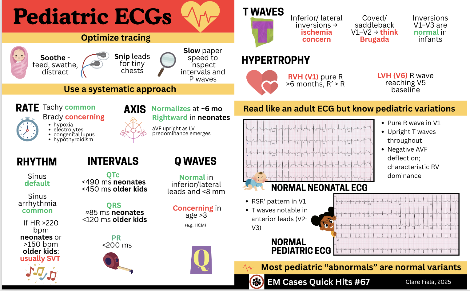 Tick Borne Illness Update, Pediatric ECG Interpretation, Nailbed Repair ...