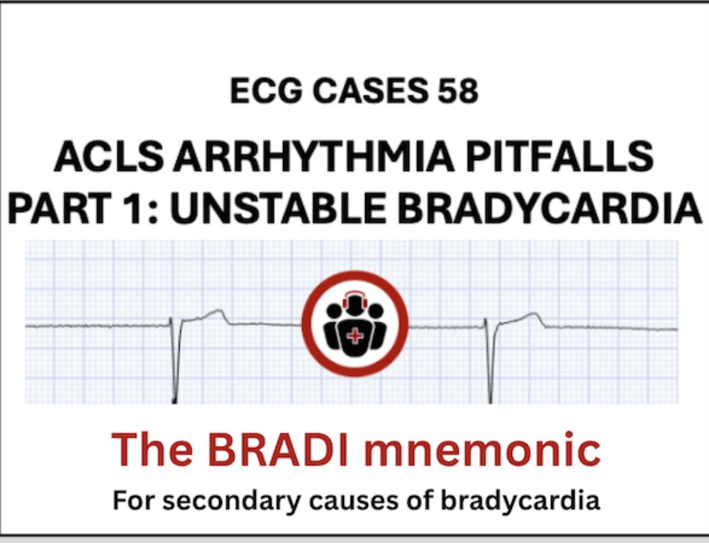 Hemoptysis ED Approach and Management | EM Cases