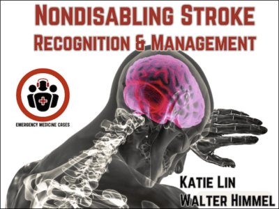 Nondisabling Stroke Recognition and Management | Emergency Medicine Cases