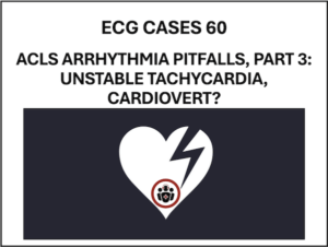 ECG Cases blog | Emergency Medicine Cases