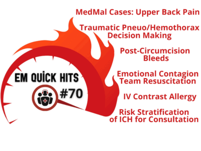 MedMal Archives - Emergency Medicine Cases