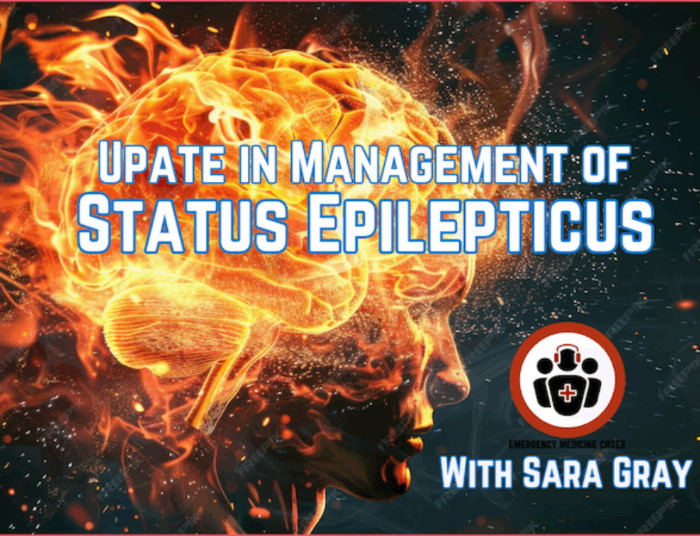 TIA Update - Risk Stratification, Workup, Dual Antiplatelet Therapy ...