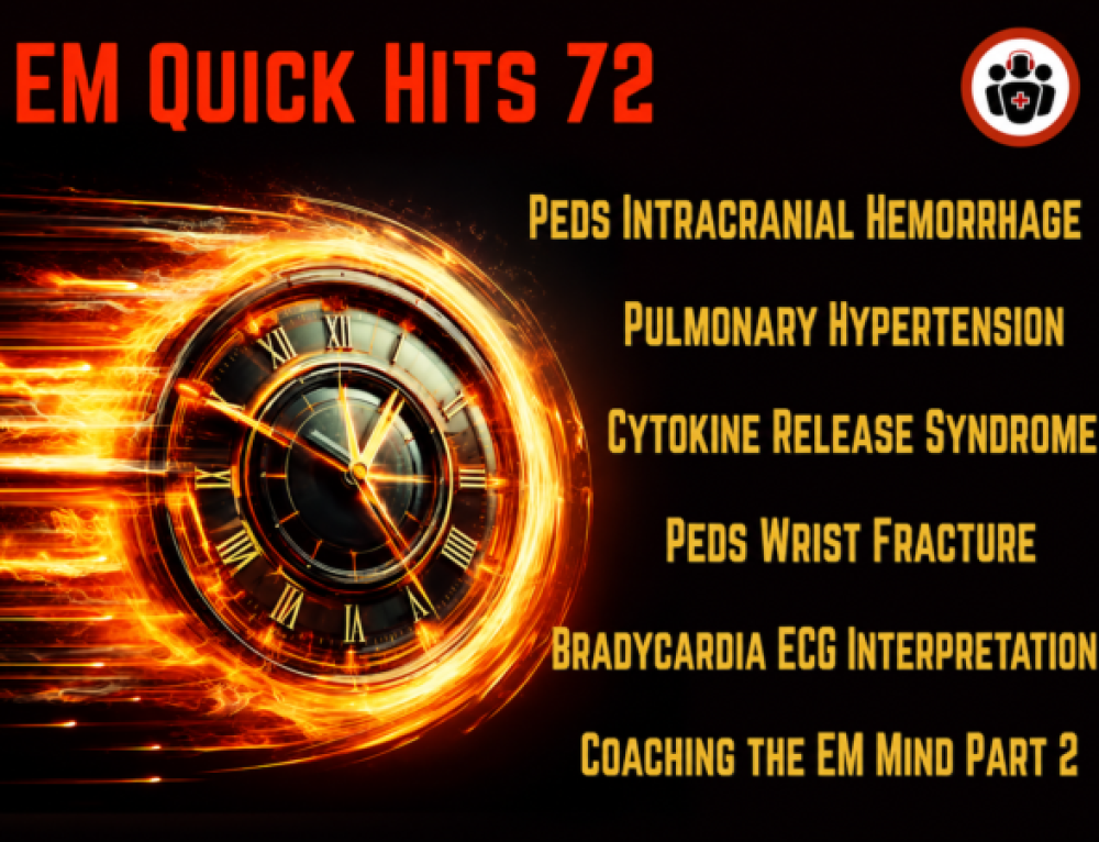 ECG interpretation in chest pain | ECG Cases | EM Cases